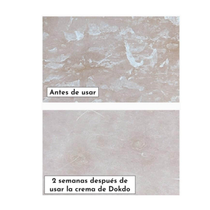 Productos — Yeppo®