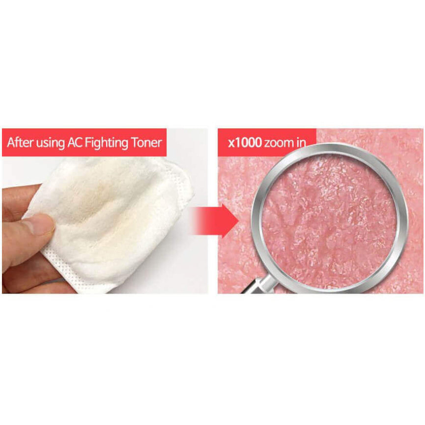 Productos — Yeppo®