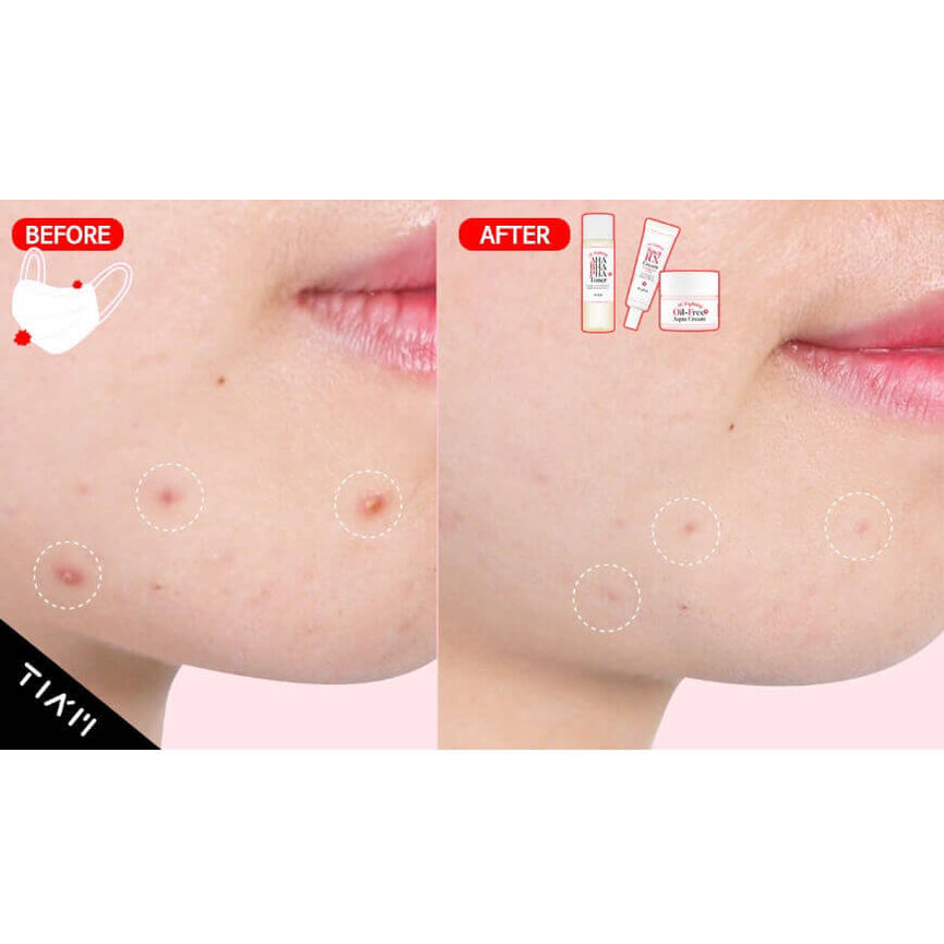 Productos — Yeppo®